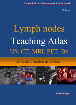 Lymph Node Reporting and Data System (LN-RADS) – Lymph Node Reporting ...