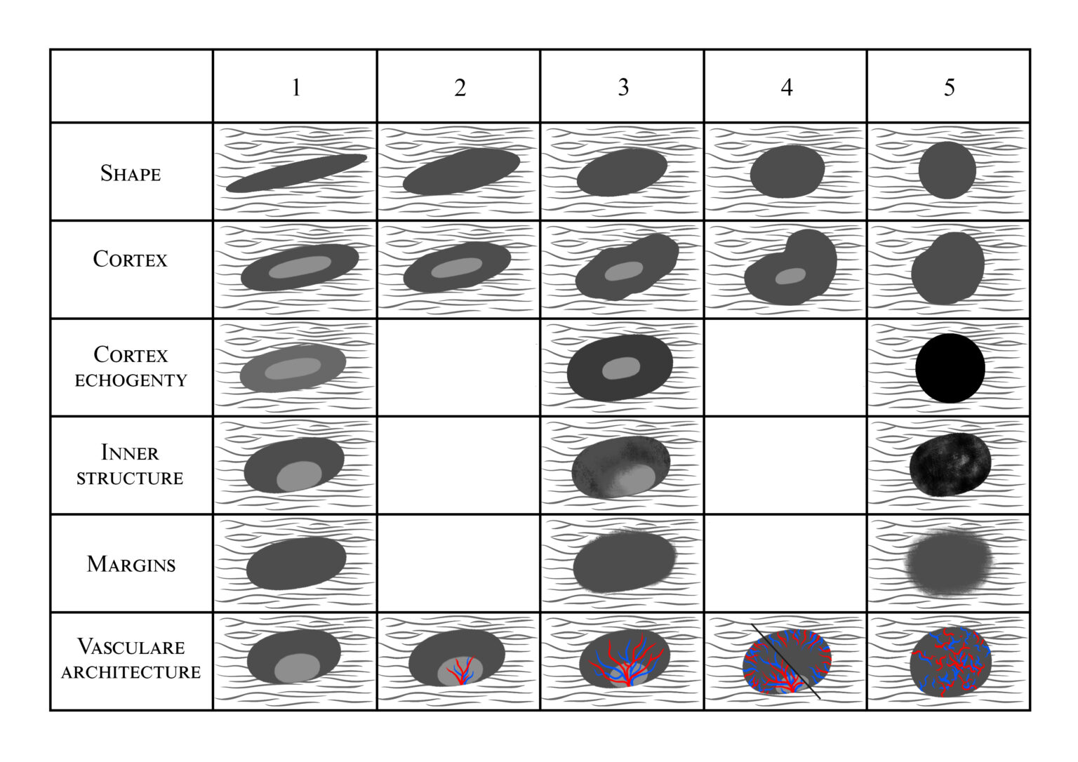 Lymph Node Reporting and Data System (LN-RADS) – Lymph Node Reporting ...