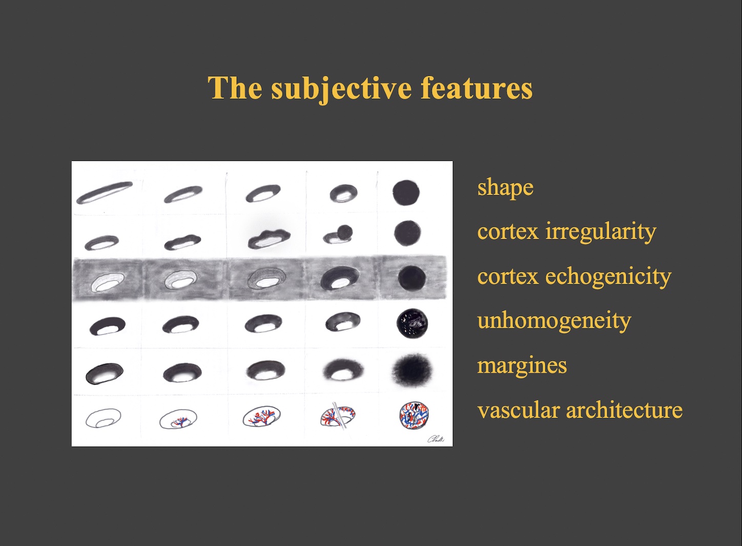 LN-RADS CASES – Lymph Node Reporting and Data System (LN-RADS)