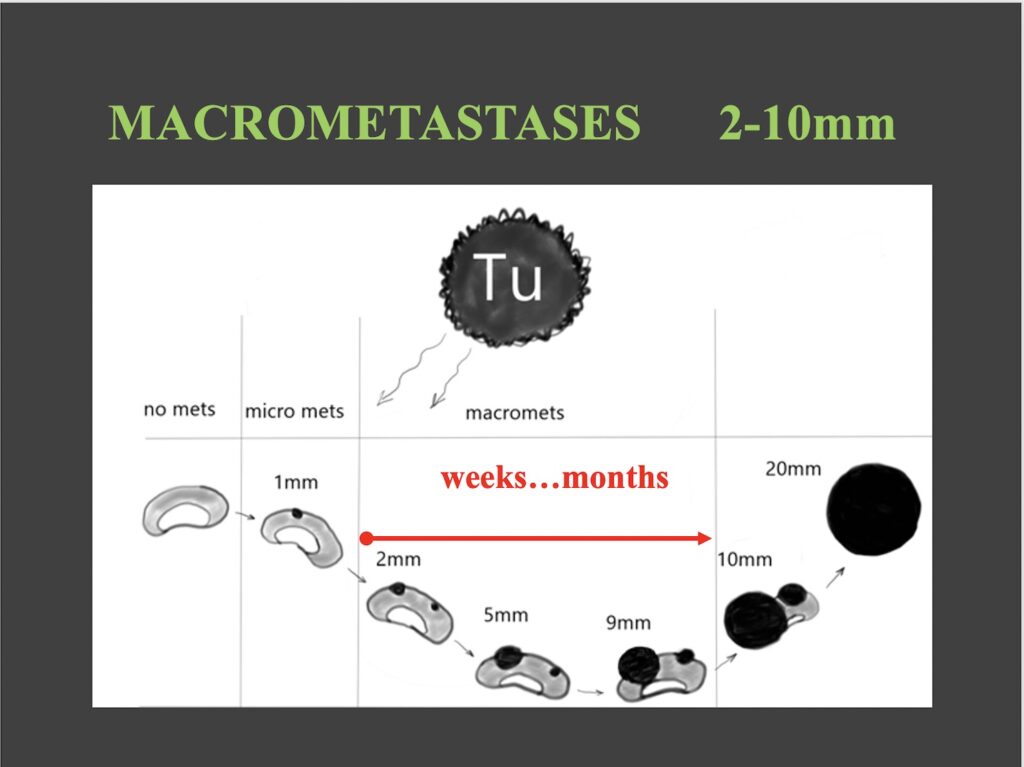 LN-RADS CASES – Lymph Node Reporting and Data System (LN-RADS)