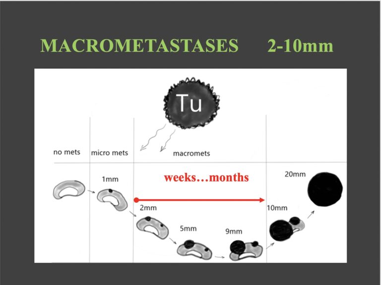 LN-RADS CASES – Lymph Node Reporting and Data System (LN-RADS)